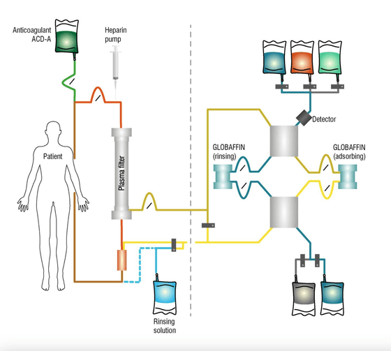Immunoadsorption Apheresis | Centre of Advanced Medicine, Frankfurt ...