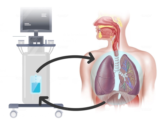 Cancer treatment with hyperthermic thoracic chemotherapy (HITHOC)