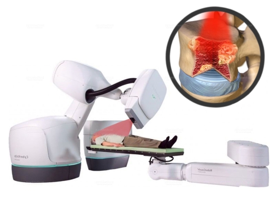 Spinal tumor treatment with CyberKnife