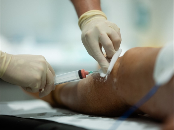 Stem Cell Therapy (Adipose/Bone-Marrow Derived) + Radiofrequency ...