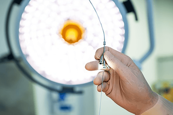 Fetoscopic Laser Coagulation of Placental Anastomoses for Twin-to-Twin ...